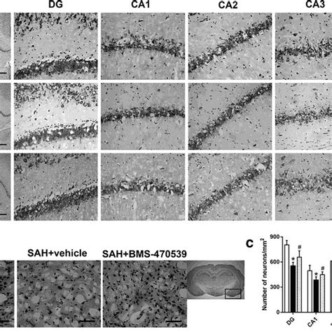 Nissl Staining Of Hippocampus And Cerebral Cortex Demonstrating Reduced