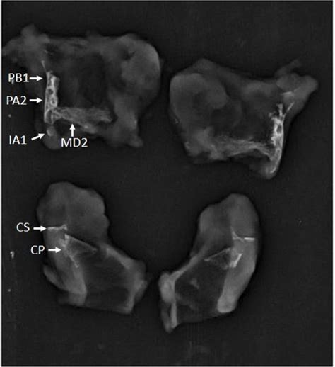 Thyroid Cartilage X Ray