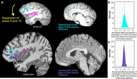 Evolution Of The Ventrolateral Prefrontal Cortical Region A As Shown On