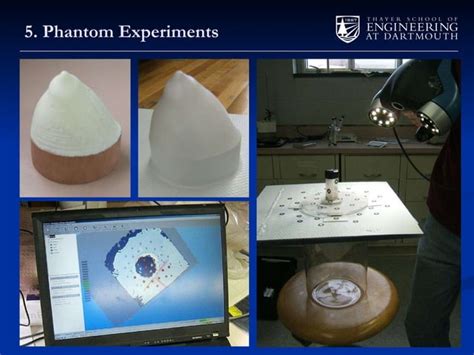 Microwave Imaging Of The Breast With Incorporated Structural