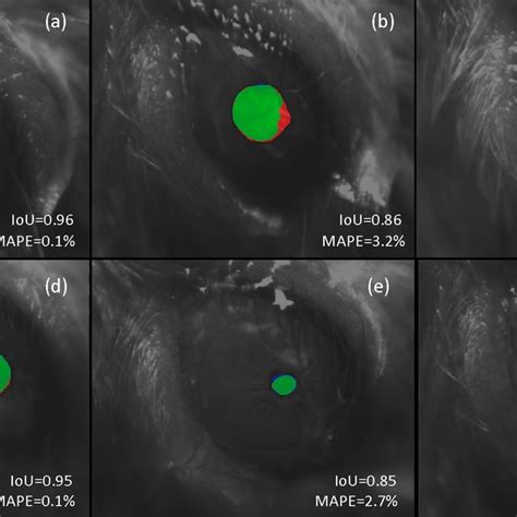 Comparison Between Automatic And Manual Pupil Segmentation The Red