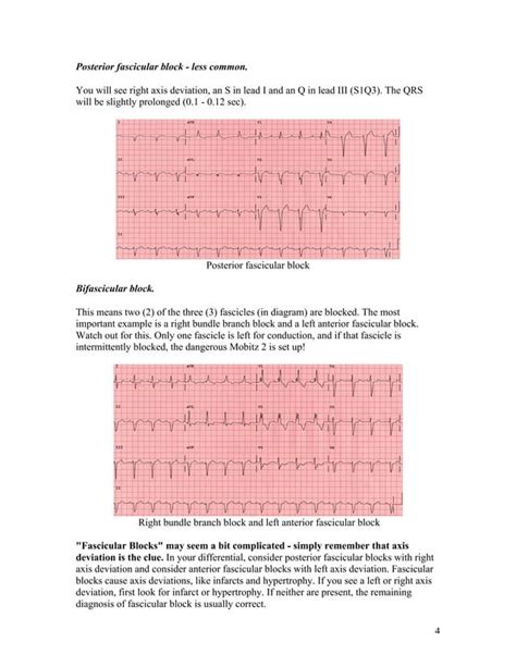 Ecg Ecg Abnormalities Pdf Heart And Cardiovascular Diseases Diseases And Conditions