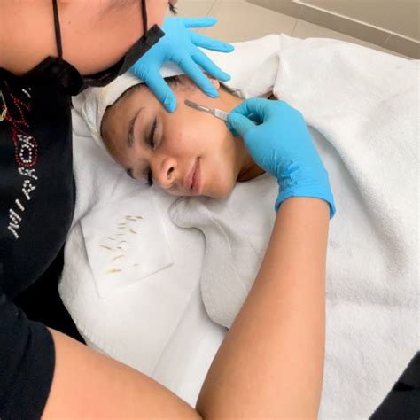 Epidermal Leveling Dermaplaning Houston Tx