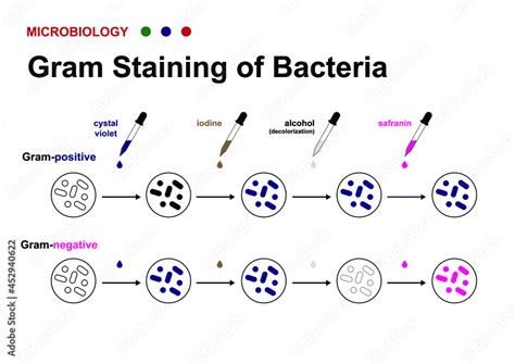 Gram Negative Bacteria Chart