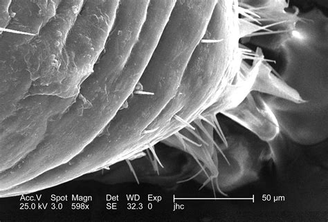 Free Picture Scanning Electron Micrograph Dorsal Unidentified Male Dermacentor