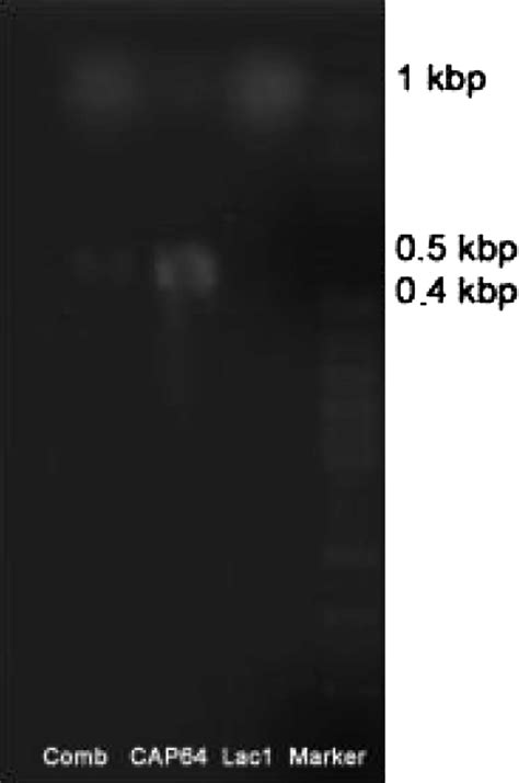 Molecular Characterization Of Cryptococcus Spp Identification Of This Download Scientific