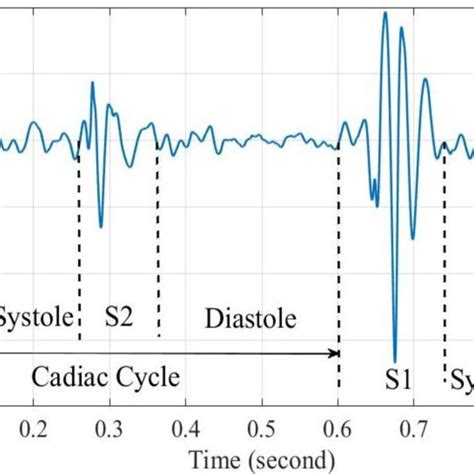 A Sound Recording Of Normal Heart Pcg Signal Download Scientific Diagram