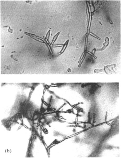 Distinctive Characteristic Of Trichoderma Citrinoviride C 9 A Download Scientific Diagram