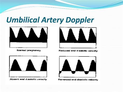 Umbilical Artery Ultrasound Fetal Growth And Well Being Assessment