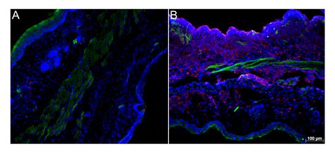 Regulating The Immune System