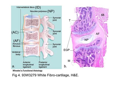 Block6 1 Fig 4a The Intervertebral Joints
