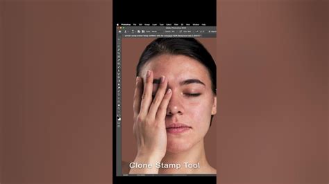 Remove Acnes In 1 Minute By Photoshop Photoshop Adobephotoshop Shortvideos Shorts Youtube