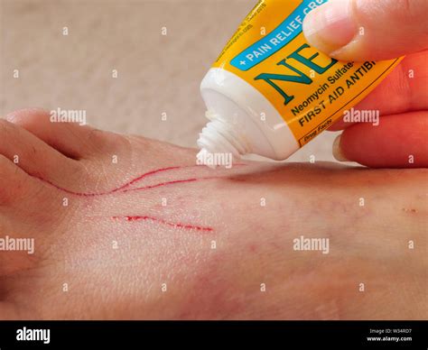 Scratch Marks On Skin