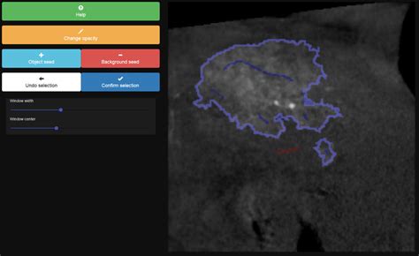 Semi Manual Segmentation Prototype User Interface The Current