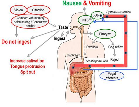 Anatomy Of Vomiting
