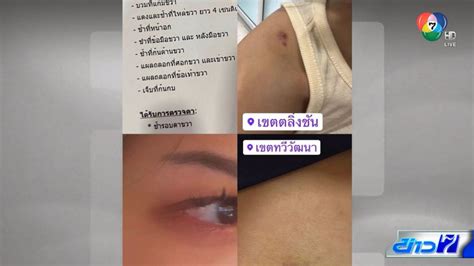 ข่าวว่าที่ สส พรรคก้าวไกล ทำร้ายร่างกายแฟนสาว