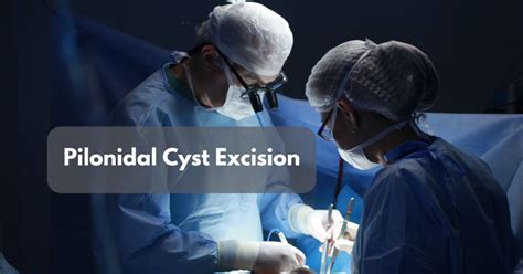 What Is A Complicated Excision Of A Pilonidal Cyst