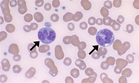 Monocytes Cells And Smears