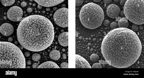Electron Microscope Images Atom