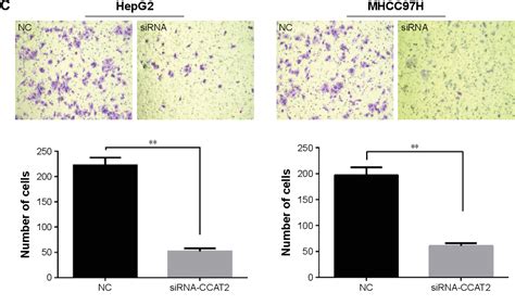 Figure 2 From Long Non Coding Rna Ccat 2 Is Associated With Poor Prognosis In Hepatocellular