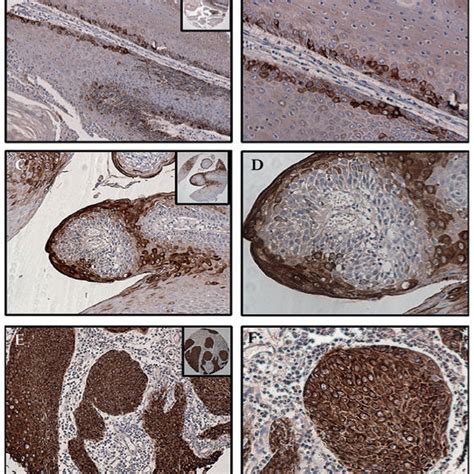 Secretion Of Human Muc4 By Transfected Cell Lines Download Scientific Diagram