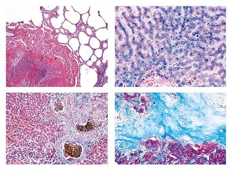 Human Pathology Slide Sets