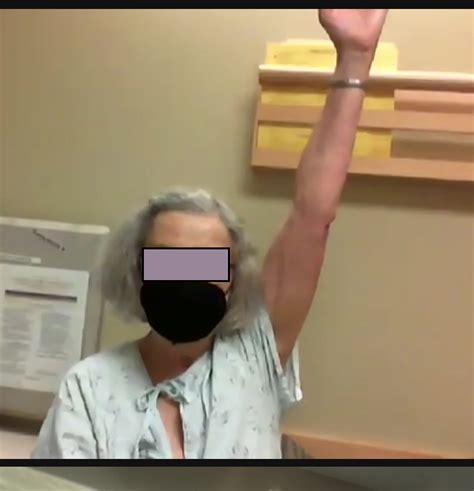 Uw Shoulder And Elbow Academy Fracture Sequelae In An Active Woman