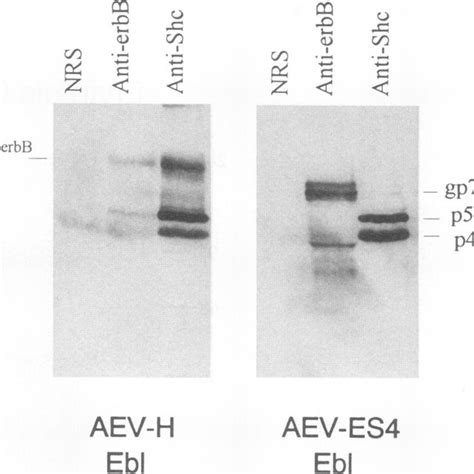 Shc Is Phosphorylated On Tyrosine Residues In Erythroid Cells