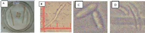 Microscopic Features Of Fusarium Isolates A Slide Culture Download Scientific Diagram