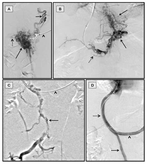 Technical Challenges To Tips And Modifications In Approach Encyclopedia Mdpi