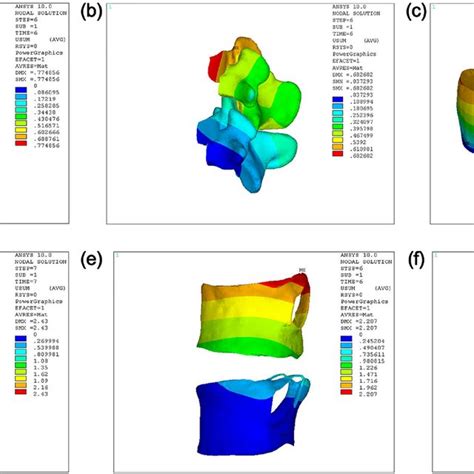 Finite Element Model Of The Lumbar L4 5 Vertebral Body And Download Scientific Diagram