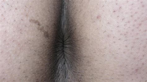 Asshole Close Up Xhpzc Eporner