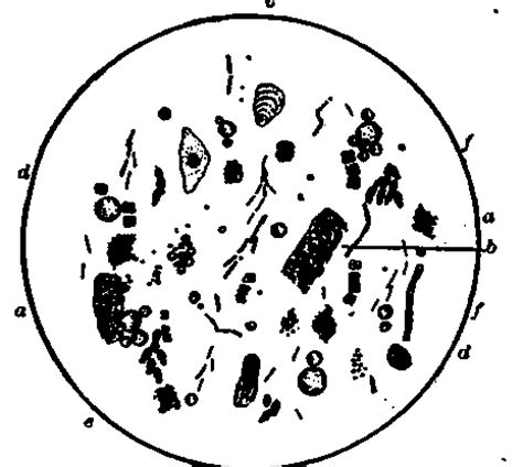 Microscopical Examination Of The Gastric Contents