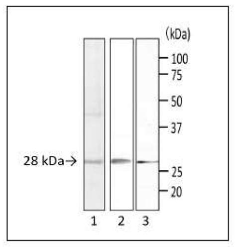 Anti Staphylococcus Aureus Enterotoxin A Enterotoxin B Antibody [sa 01] Gtx00864 Genetex