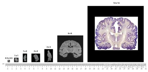 华大时空转录组stereo Seq 精准定位基因表达的细胞宇宙地图 知乎