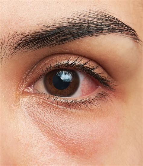 Eyemetagenomics Ltd