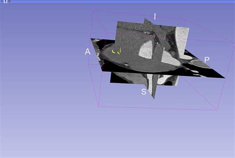 Vtk Surface Mesh To Segmentation Support 3d Slicer Community