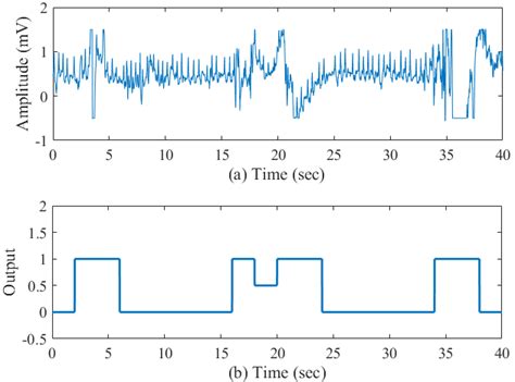 A Sample Af Ecg Segment And B Noise Artifact Detection Output For
