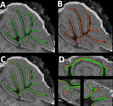 4 The Wm Segmentation A After Label Propagation From The Group