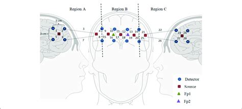 Partitioning The Prefrontal Cortex Only A Subregion Showing The