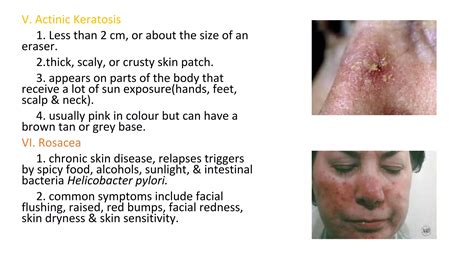 Skin Structure Function And Disease Ppt