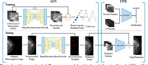 Figure 2 From Cascaded Generative And Discriminative Learning For Microcalcification Detection