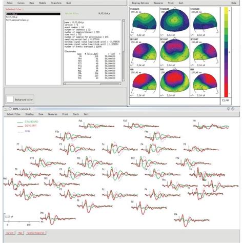 EEG Vizualisation Tool For Continuous Data Eeg File With An Example Download Scientific