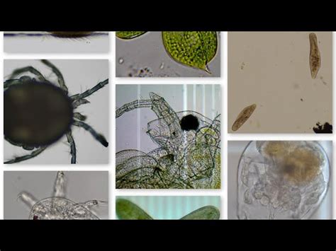 Types Of Algae Under Microscope