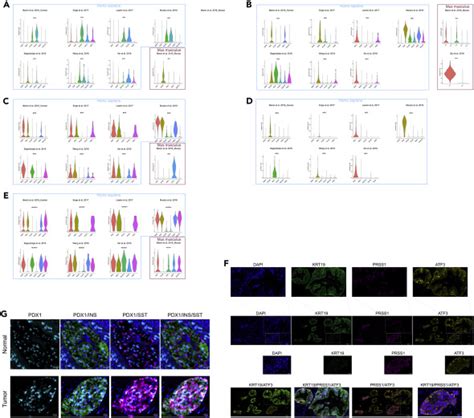 Single Cell Rna Seq Transcriptomic Landscape Of Human And Mouse Islets And Pathological