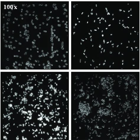 Hyperspectral Microscope Images Collected At 650 Nm Of Mixed Bacteria