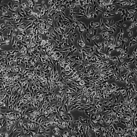 小鼠前列腺癌细胞rm 1 小鼠 细胞系 南京森贝伽生物科技有限公司