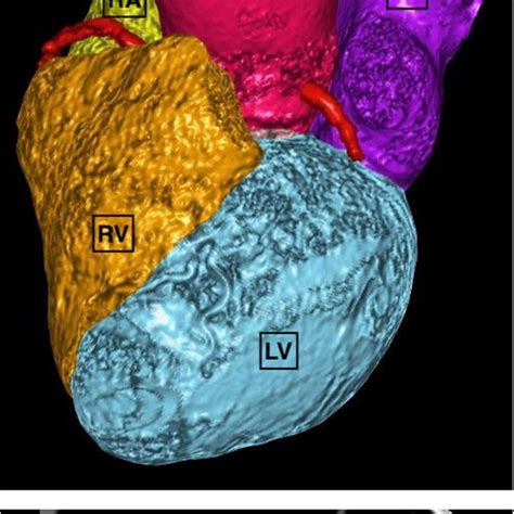 Automated 3 Dimensional Segmentation Of Myocardial Volumes A B Download Scientific Diagram