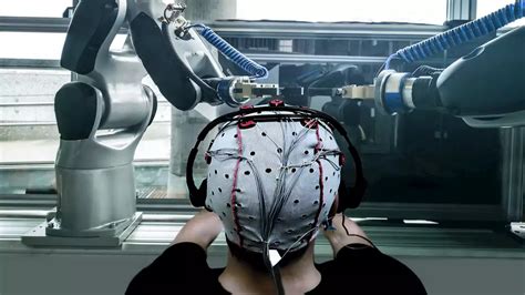 This New Ai Powered Robot Can Perform Minimally Invasive Bra