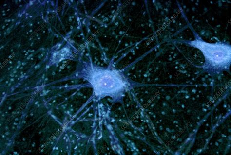 Nerve Cells Light Micrograph Stock Image P3600557 Science Photo
